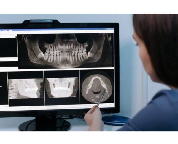 OPG/Dental X-Ray – Alpha Diagnostic Center